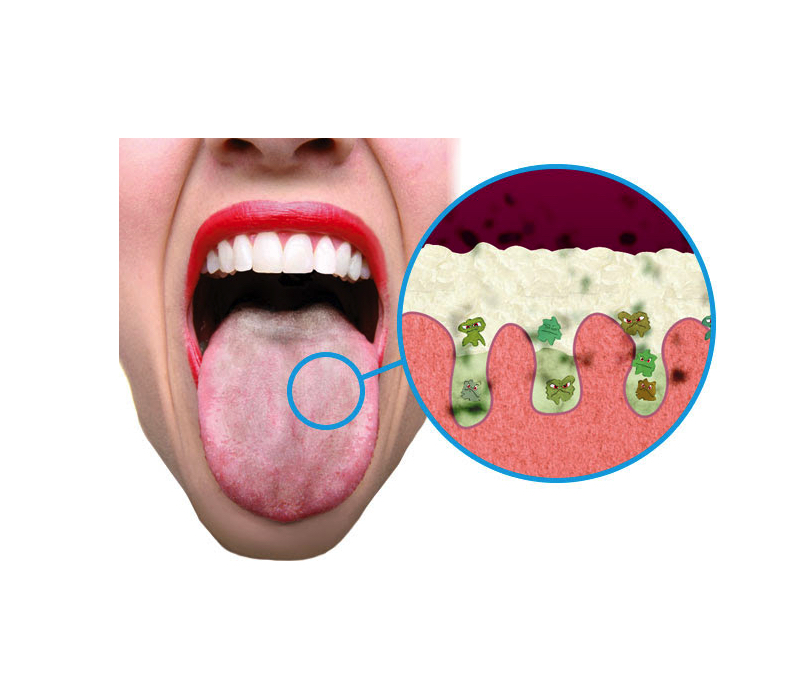 Amandelstenen | Zó maak je er korte metten mee! - Amandelstenen | 10 ...